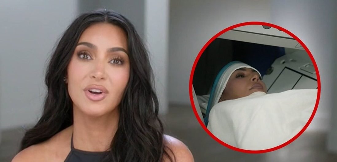 Kim Kardashian enfrenta un aneurisma cerebral tras su divorcio con ...
